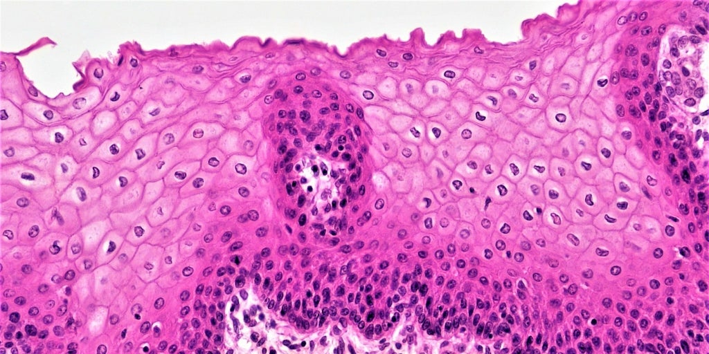 They Design A Cell Glue To Regenerate Tissues And Heal Wounds Time News they-design-a-cell-glue-to-regenerate-tissues-and-heal-wounds-time-news
